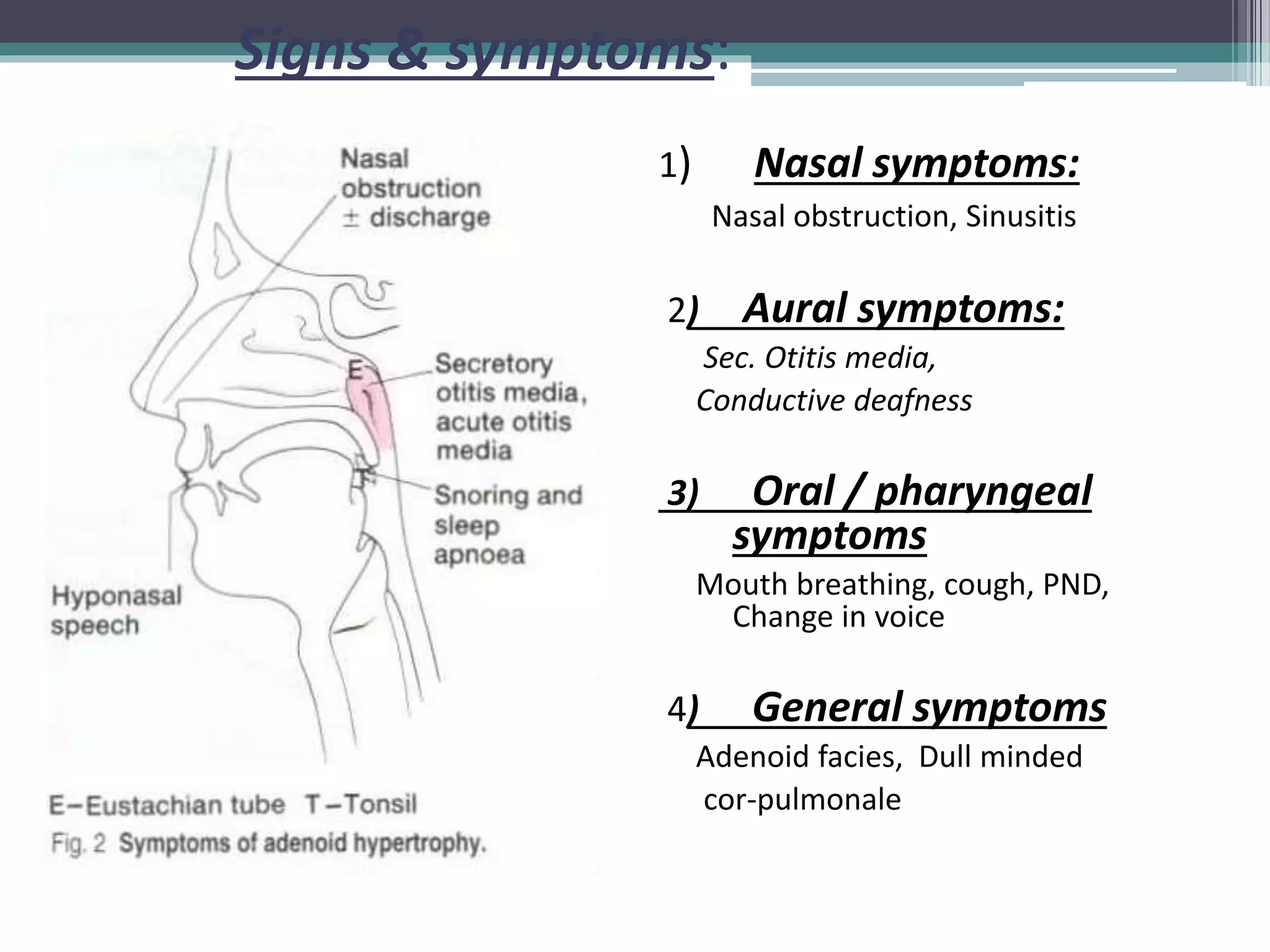 Diseases of tonsils and adenoids | PPTX