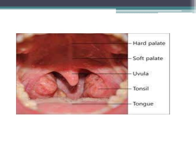 Diseases Of Tonsils And Adenoids Pptx Ear Nose And Throat 8248