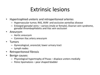 Diseases of ureters | PPTX
