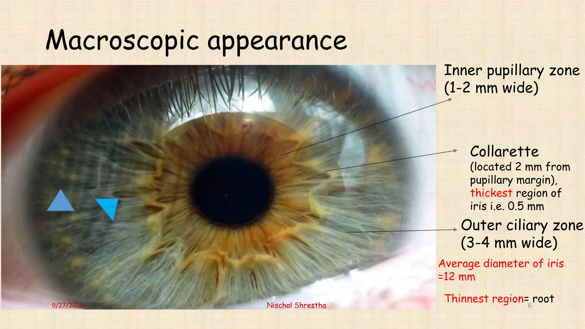 Anatomy of uveal tract- ophthalmology | PPTX