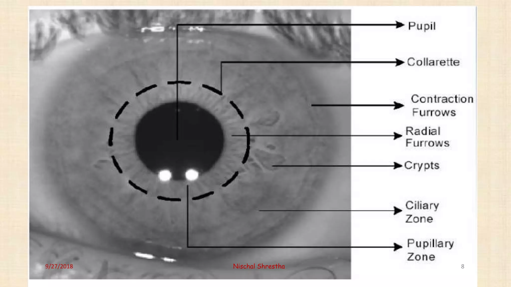 Anatomy of uveal tract- ophthalmology | PPTX