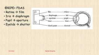 Anatomy of uveal tract- ophthalmology | PPTX
