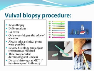 DISEASES OF VULVA -BENIGN AND MALIGNANT | PPT