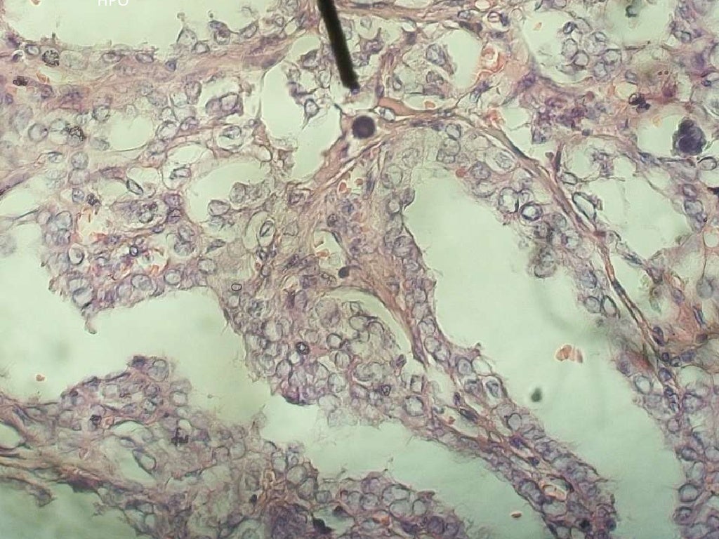 Diseases Of Wbc diseases-of-wbc