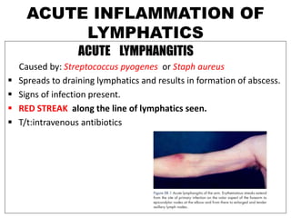 Diseases related to lymphatic system | PPTX | Cancer | Diseases and ...