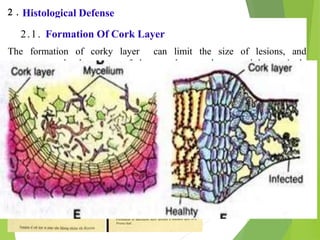 Diseases resistance and defence mechanisms | PPTX