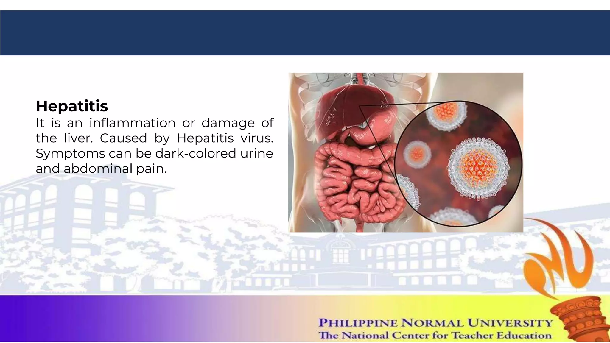 Diseases that Affect the Major Organs of the Human Body and Ways to ...