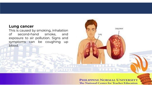 Diseases that Affect the Major Organs of the Human Body and Ways to ...