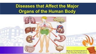 Diseases that Affect the Major Organs of the Human Body and Ways to ...
