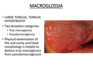 Diseases of tongue | PPTX
