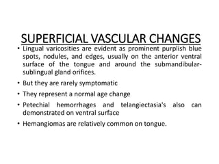 Diseases of tongue | PPTX
