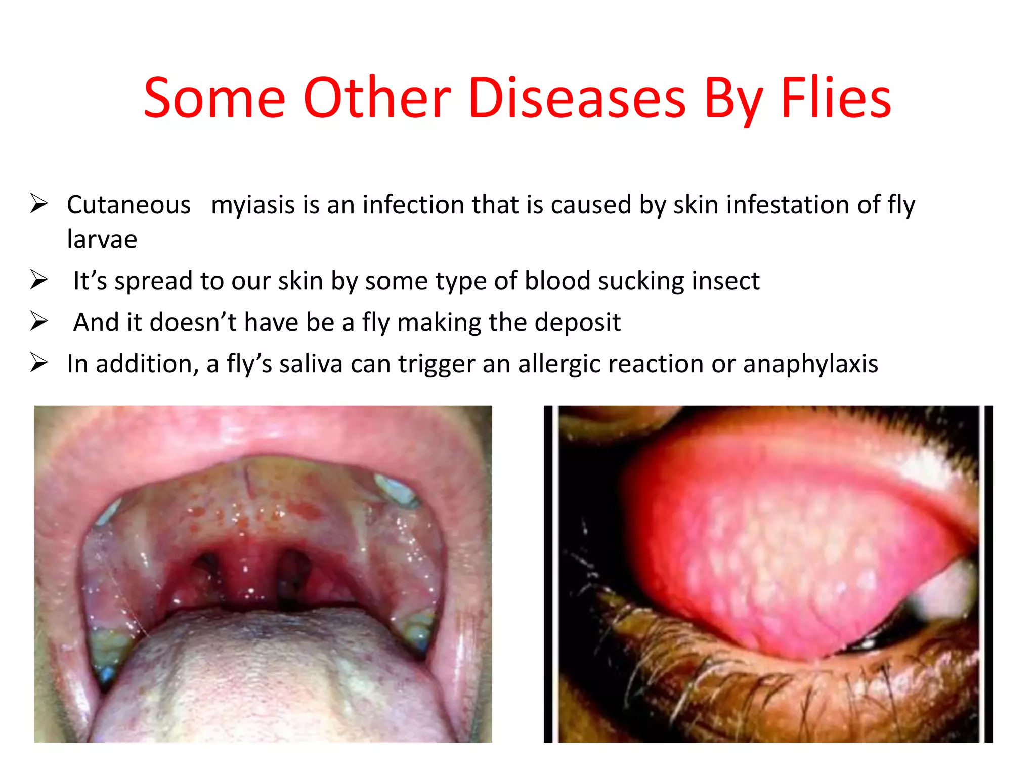 Disease transmitted by flies | PPTX