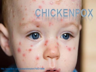 Disease Vocab | PPTX