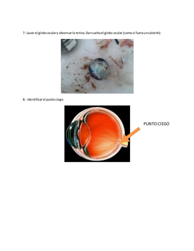 Disección de ojo de vaca.