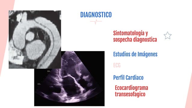 Diseccion Aortica Stanford B | PPT