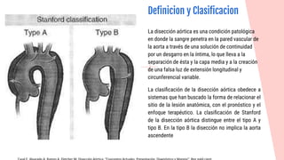 Diseccion Aortica Stanford B | PPTX