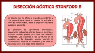 Disección aórtica Stanford B.pptx