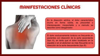 Disección aórtica Stanford B.pptx
