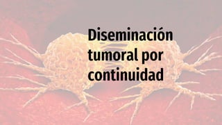 diseminacion.pptx