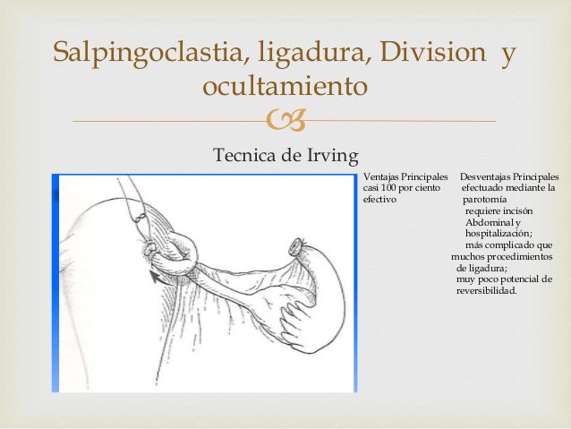 Disertacion sobre la trompa y tecnica de salpingoclastia, dr. ortega