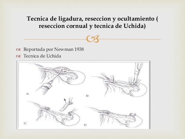 Disertacion sobre la trompa y tecnica de salpingoclastia, dr. ortega