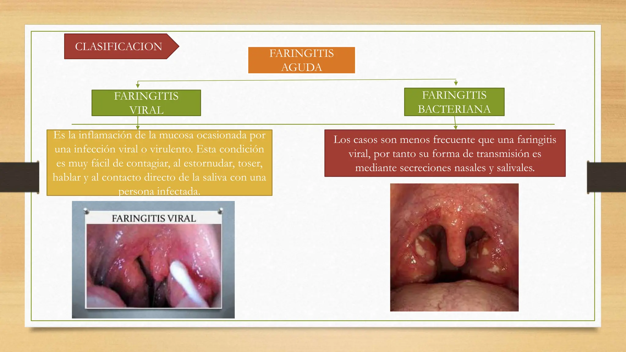 DISERYTACION DE FARINGITIS.pmmmmmmmmmmptx | PPTX