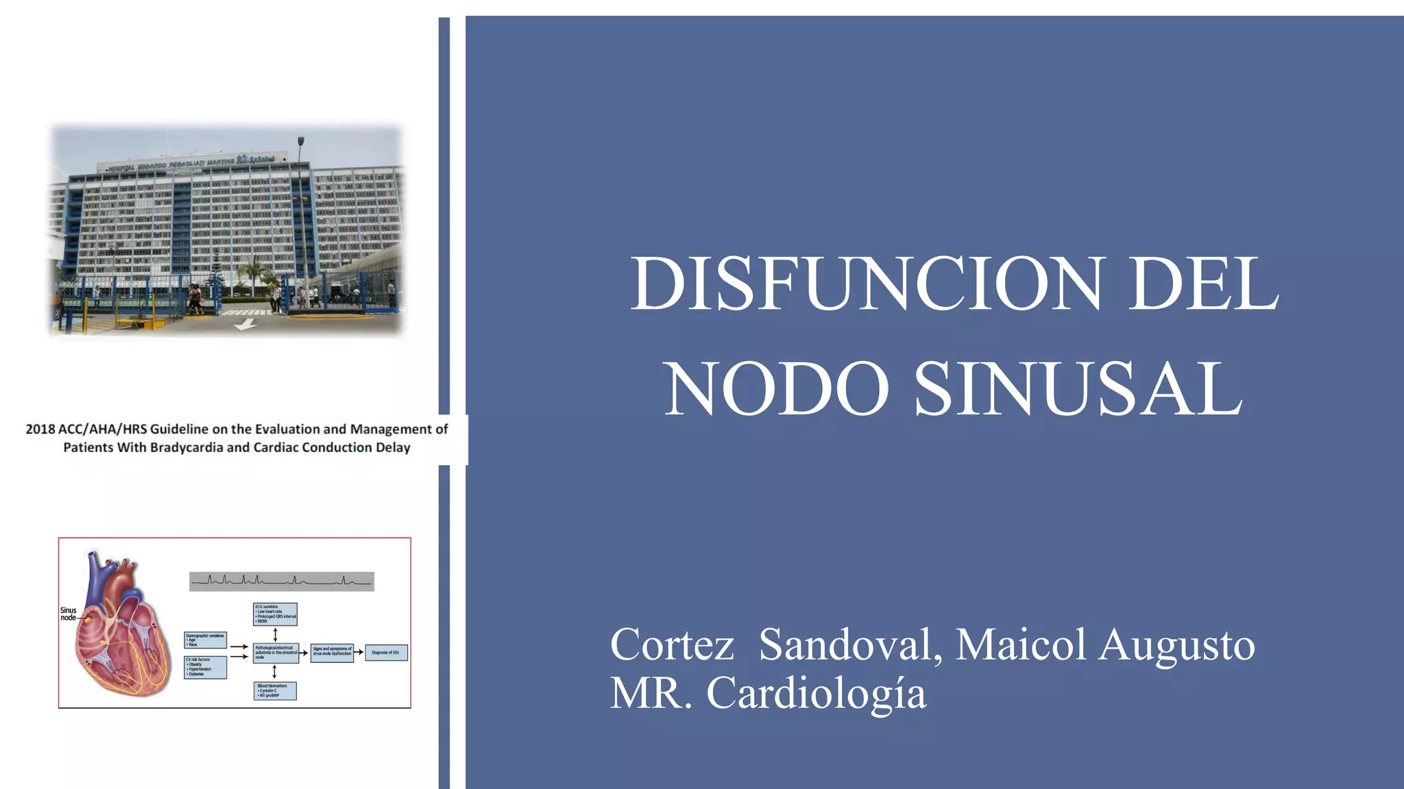 DR.MAICOL AUGUSTO CORTEZ SANDOVAL/Disfuncion del nodo sinusal | PPT