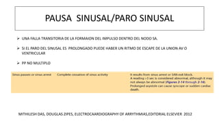 DR.MAICOL AUGUSTO CORTEZ SANDOVAL/Disfuncion del nodo sinusal | PDF