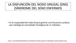 DR.MAICOL AUGUSTO CORTEZ SANDOVAL/Disfuncion del nodo sinusal | PDF