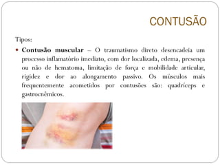 Principais Disfunções Musculoesqueléticas | PDF