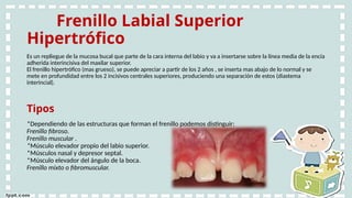 PRESENTACIÓN TIPOS DISGLOSIA LABIAL.pptx