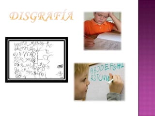 Disgrafia | PPTX