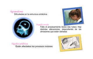 Disgrafia y discalculia | PPTX