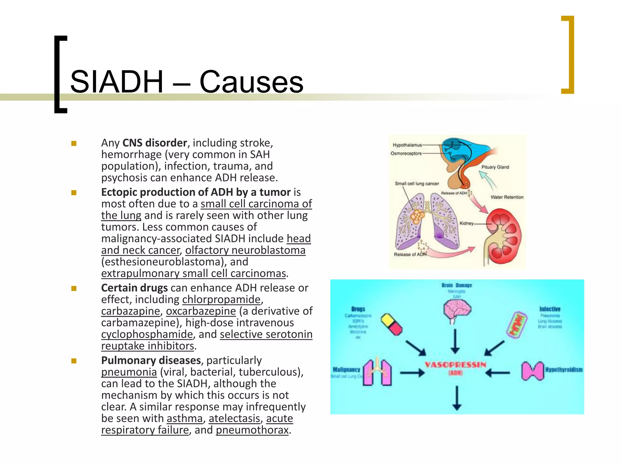 Di, siadh and cerebral salt wasting syndrome | PPT