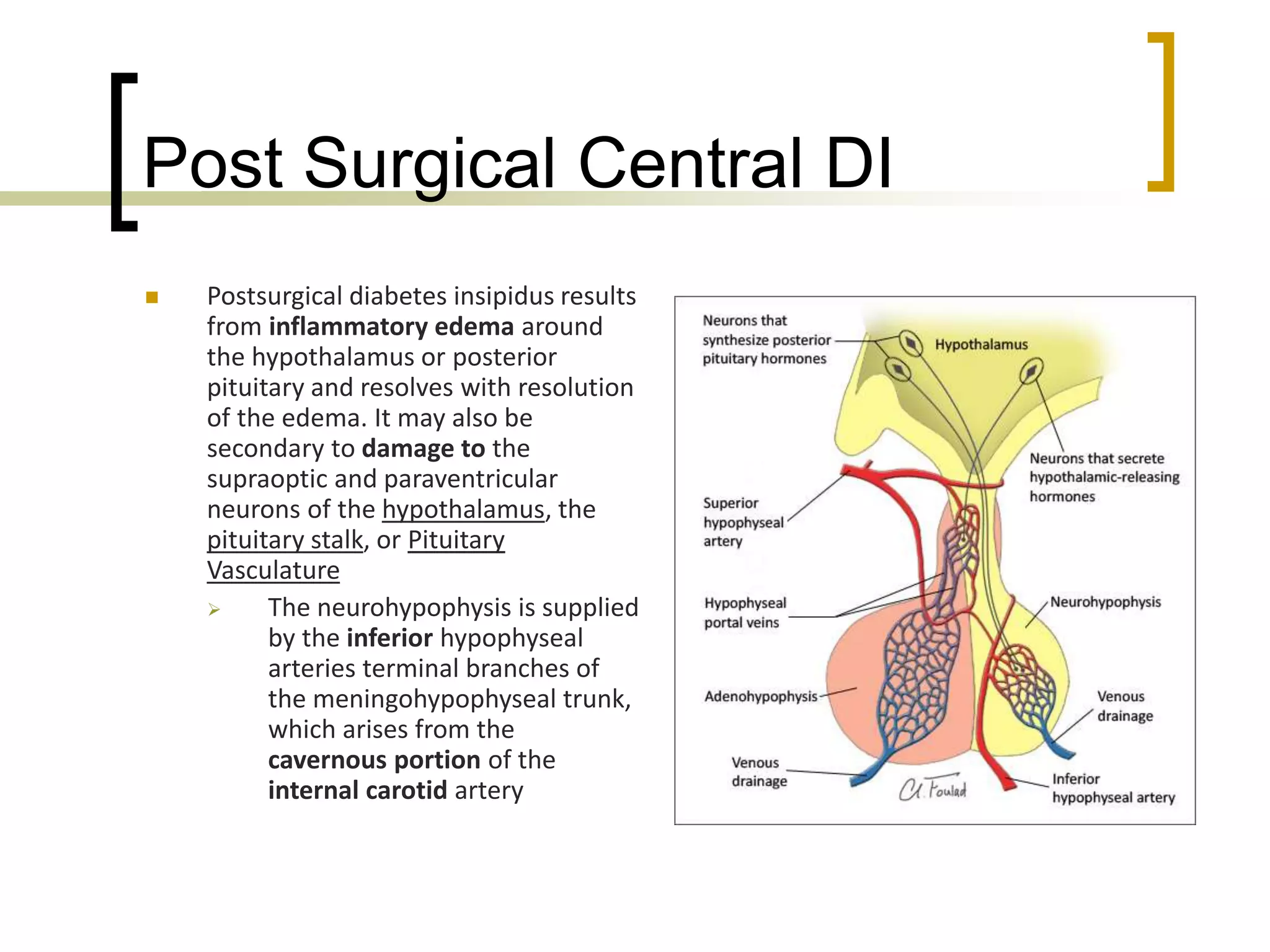 Di, siadh and cerebral salt wasting syndrome | PPT