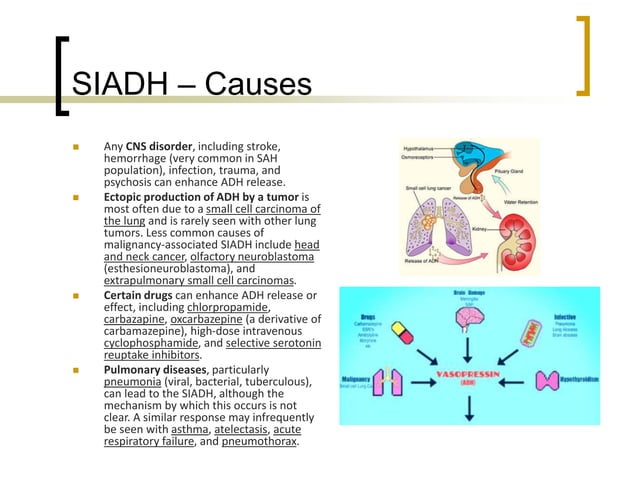 Di, siadh and cerebral salt wasting syndrome | PPT