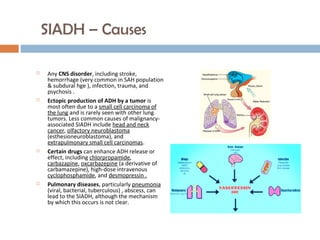 Di, siadh and csws | PPT