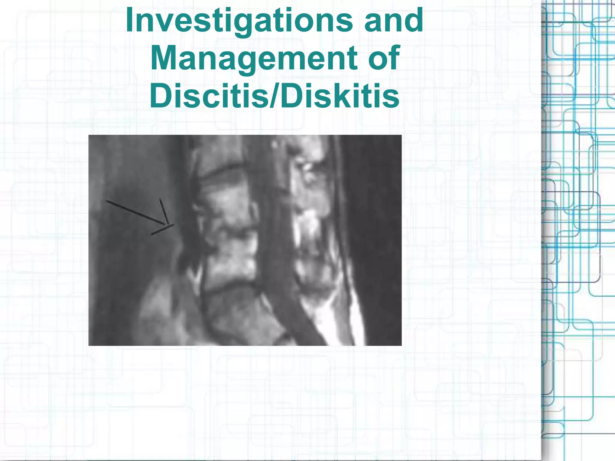 Diskitis | PPT
