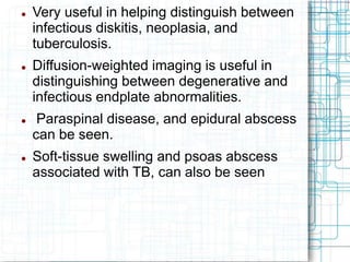 Diskitis | PPT