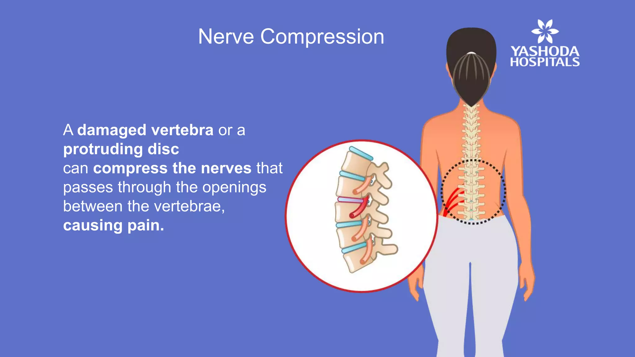 Spine Disc Surgeries - Discectomy and Decompression | PPTX