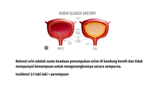 Diskusi Bedah Urologi - Retensi Urin.pptx