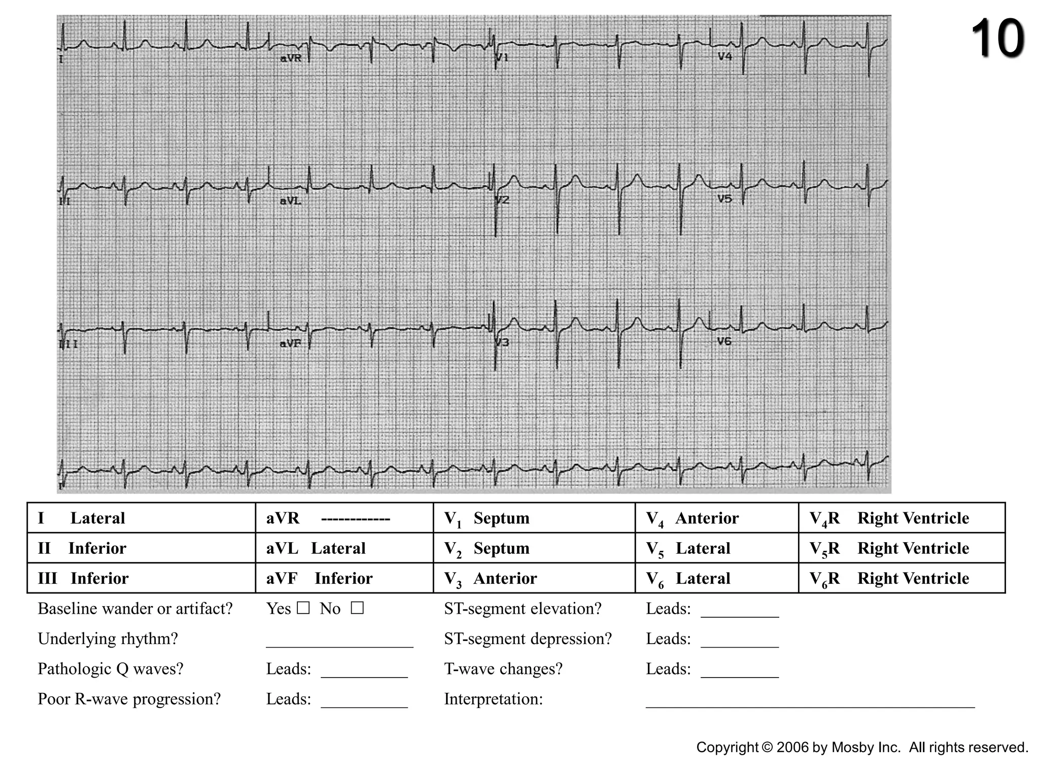 DISKUSI KASUS EKG DASAR 12 LEAD - KUNCI(edit).pdf