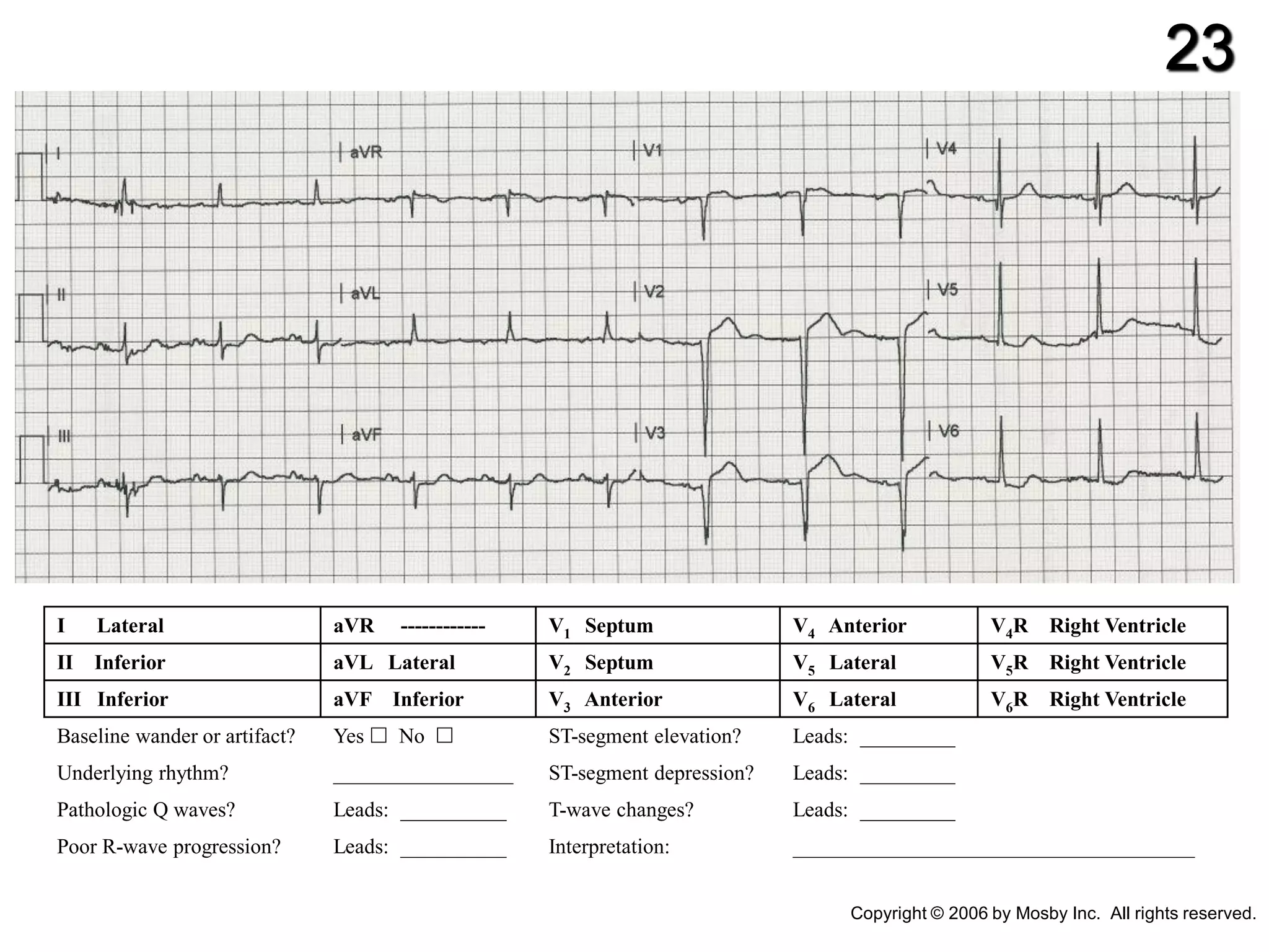 DISKUSI KASUS EKG DASAR 12 LEAD - KUNCI(edit).pdf