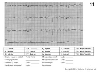 DISKUSI KASUS EKG DASAR 12 LEAD - KUNCI(edit).pdf