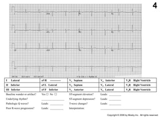 DISKUSI KASUS EKG DASAR 12 LEAD - KUNCI(edit).pdf