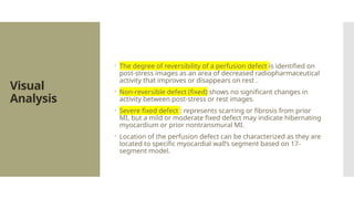 Nuclear Cardiology Imaging about Myocardial Perfusion Scintigraphy ...
