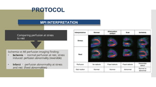 Nuclear Cardiology Imaging about Myocardial Perfusion Scintigraphy ...