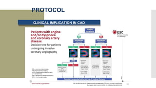Nuclear Cardiology Imaging about Myocardial Perfusion Scintigraphy | PPTX