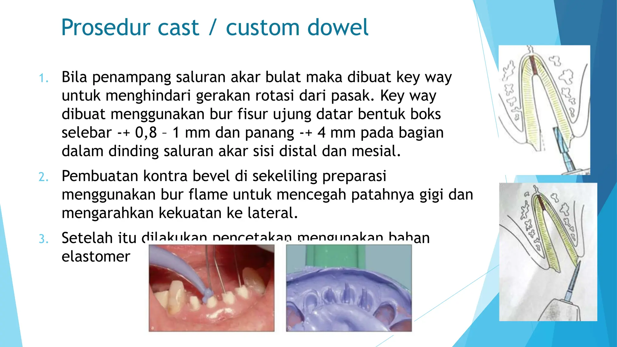 diskusi pasak dan mahkota jaket psa gigi | PPTX