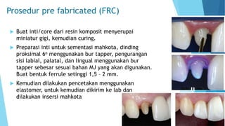 diskusi pasak dan mahkota jaket psa gigi | PPTX